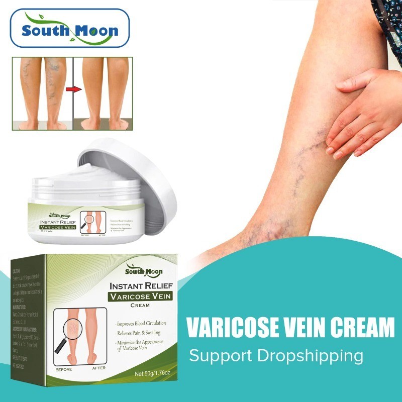 Effective Varicose Vein Relief Cream Eliminate Dilated Vasculitis ...