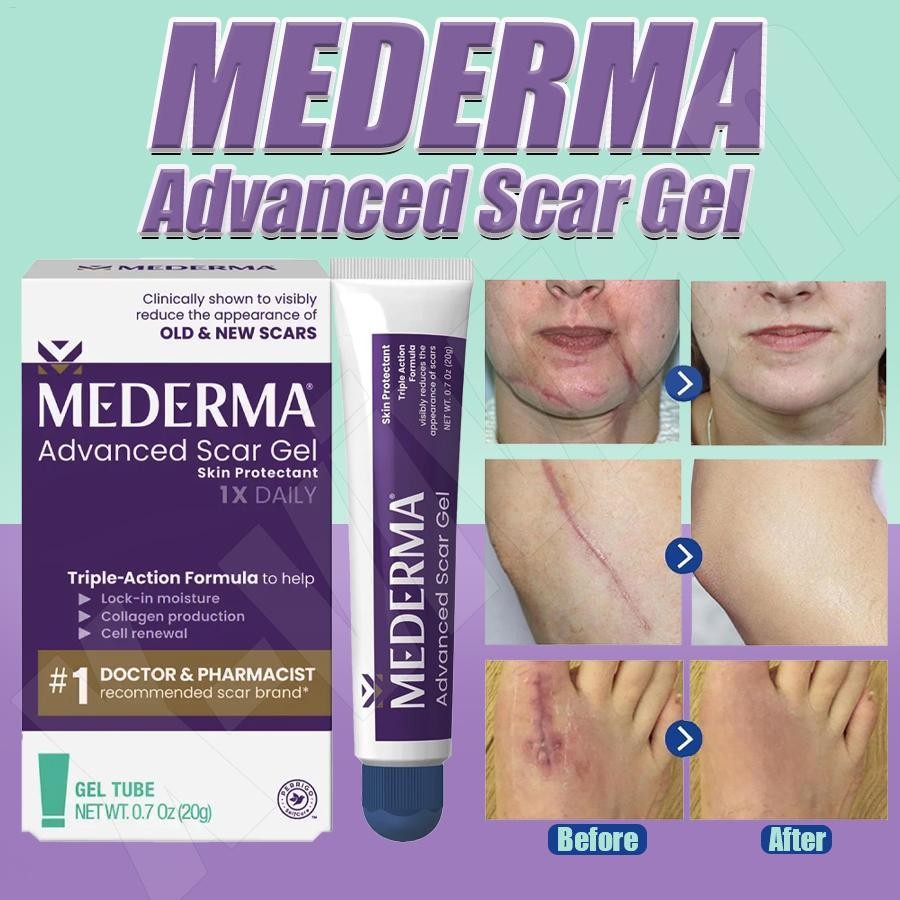 Mederma Advanced Scar Gel Skin Protectant Reduce Appearance Of Old ...