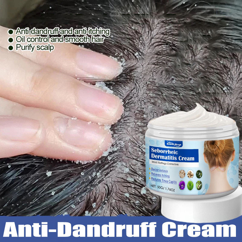 Anti-Dandruff Cream for scalp psoriasis Refreshing Oil Control Deep ...