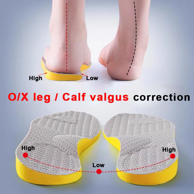 Adult O-Shaped Leg Calf Valgus Correction Insole X O-Shaped Leg Heel ...