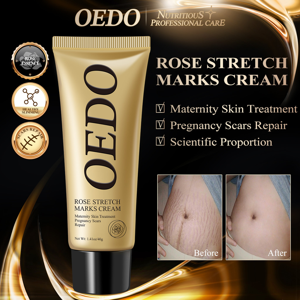 OEDO Rose Remove Stretch Marks Cream Anti Wrinkle Anti Aging Maternity ...