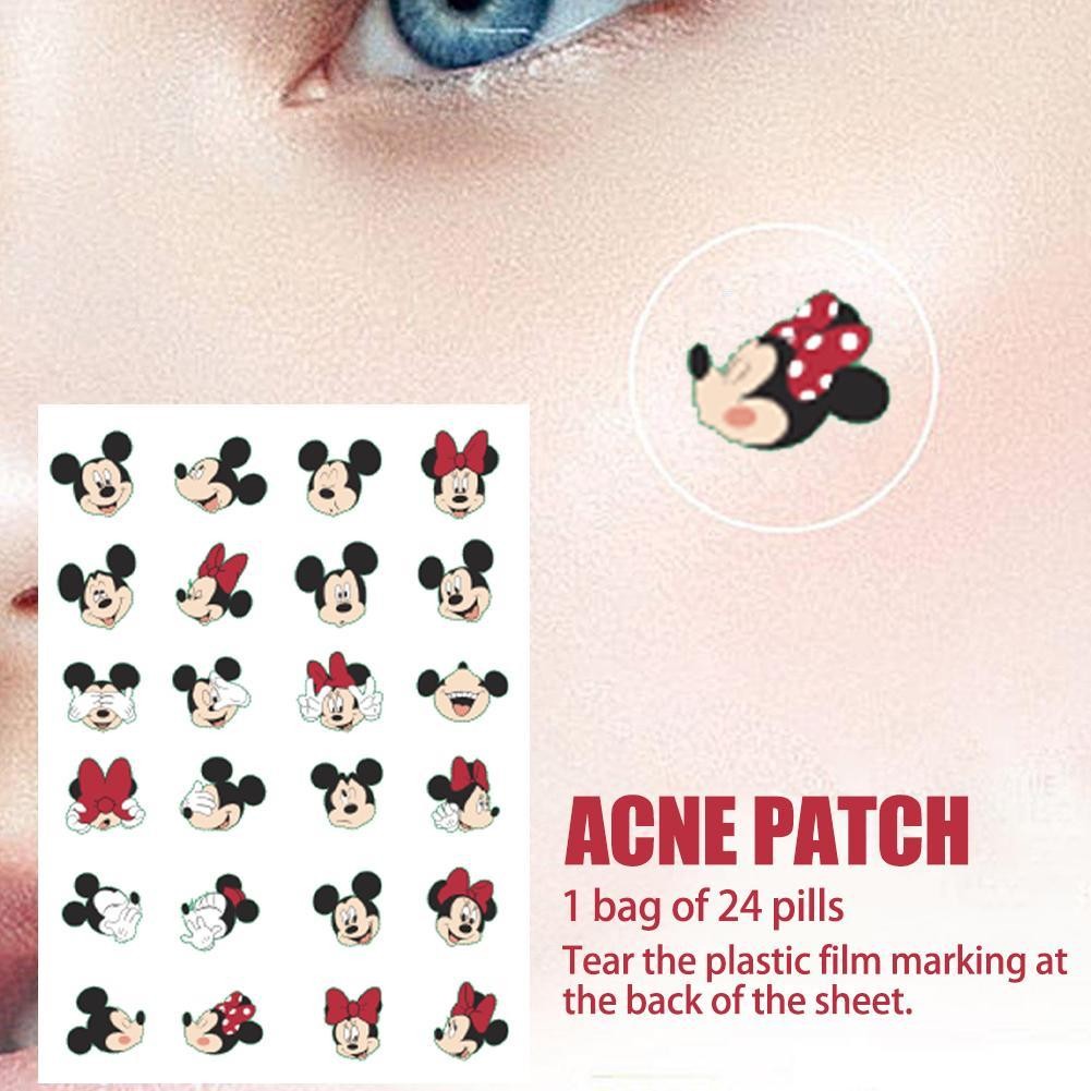 Cartoon Cute Mickey Mouse Shaped Acne Patches Beauty Sticker K4d0 ...