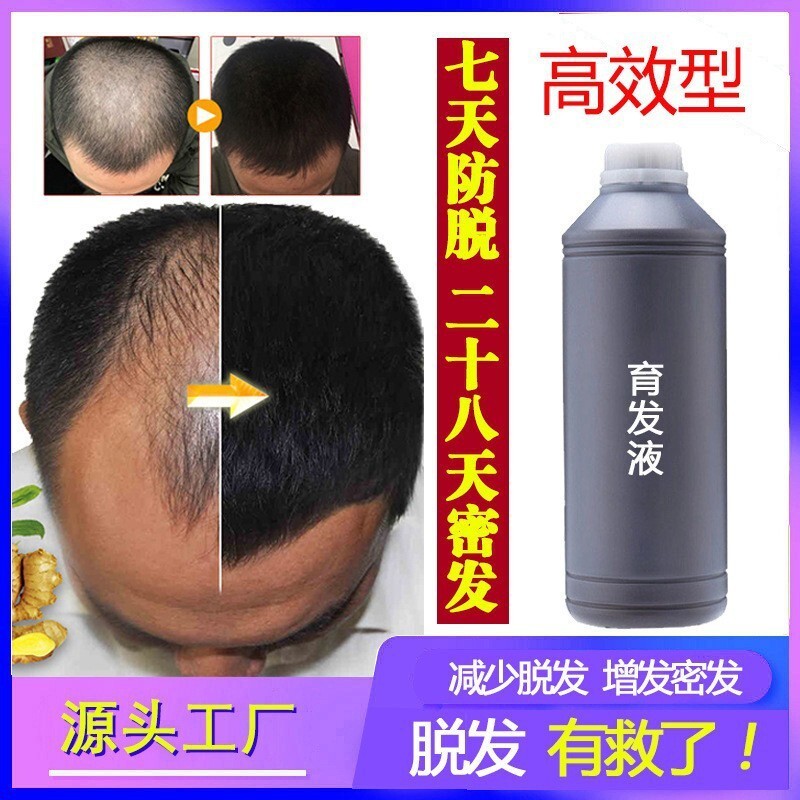Herbal Anti-Hair Loss Hair Loss Lotion Hair Extraction Agent Hair ...