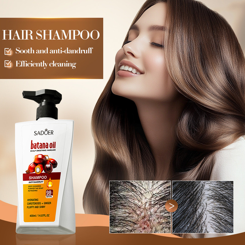 Batana Shampoo 400ml Oil Control Anti Dandruff Shampoo Reduce Dandruff Formation Nourish Hair ...