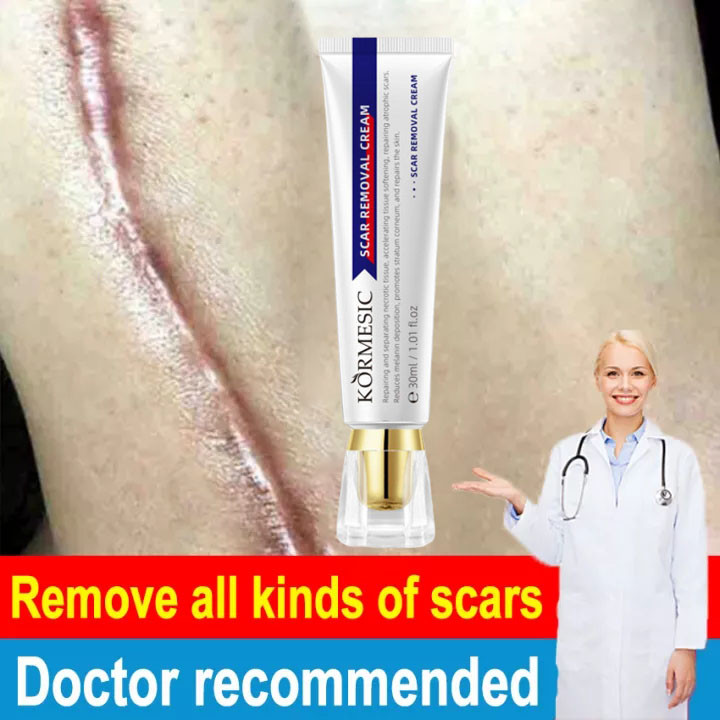 Scar Removal Cream Peklat Remover Acne Treatment Scar remover cream ...