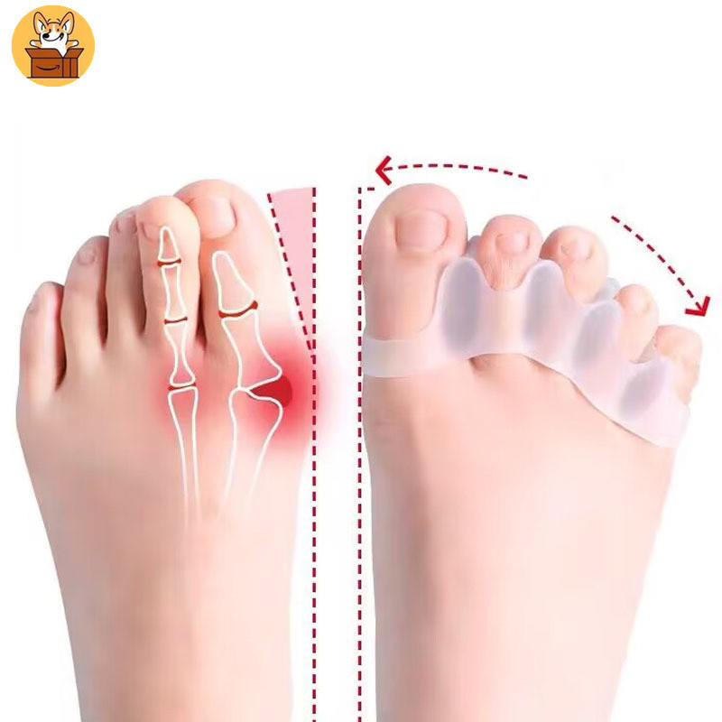 【Am-az】2Pc Silicone Toe Separator Fingers Feet Toe Spreader Hallux ...