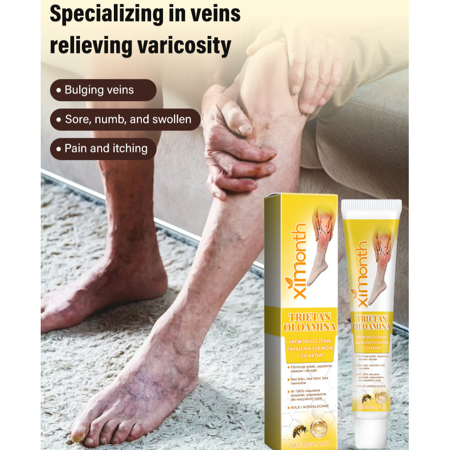 Repair of veins Leg Care Cream Varicose Vein Repair Cream Improvement ...