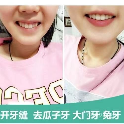 Teeth Grinding Machine Electric Cleaning Grinding Machine Dental Stones ...