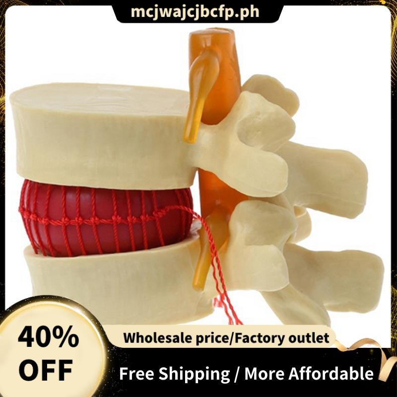 Perfect Lumbar Vertebrae Model Anatomical Spine Lumbar Disc Herniation ...