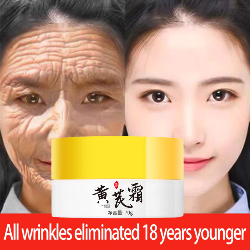 Pekas Remover Cream For Melasma And Dark spot Melasma Serum Pekas ...