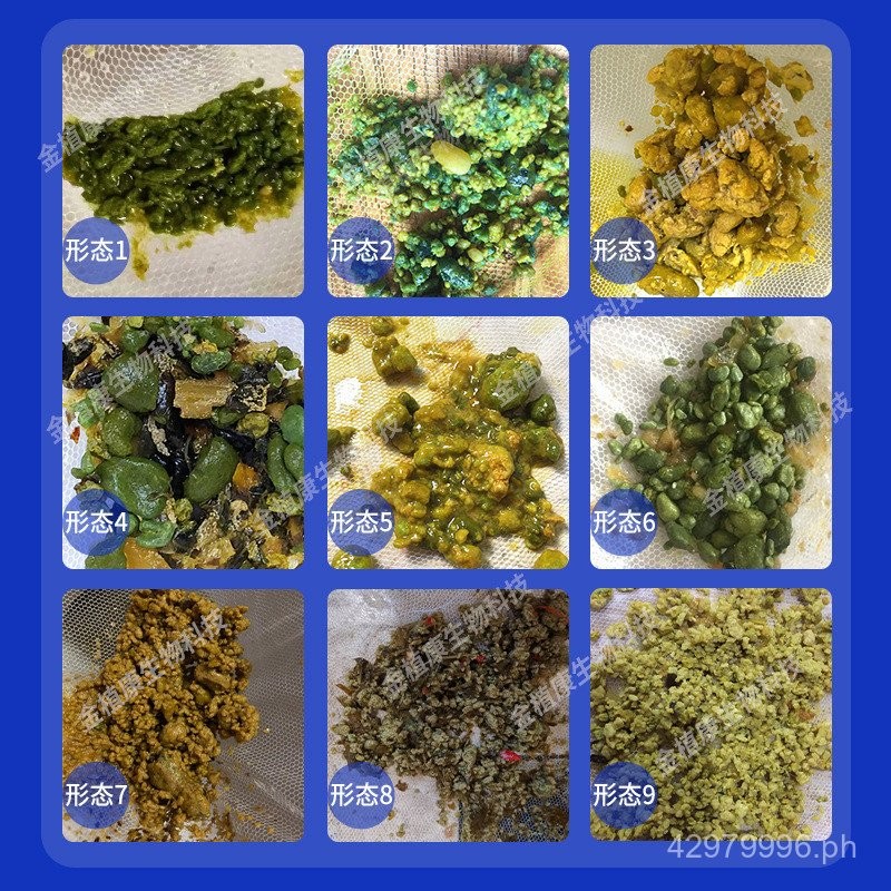 Beauty Salon Gallbladder Drainage Kit Fruit and Vegetable Powder Liver ...