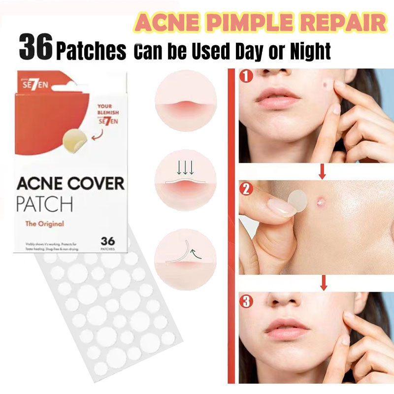 Salicylic Anti-Acne Pimple Remover Patch Blemish Treatment Skin Care ...
