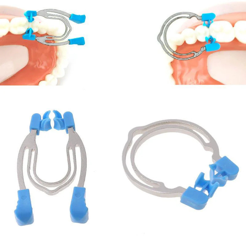 Dental Matrix Sectional Contoured Matrices Clamps Wedges Metal Spring ...