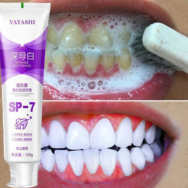 Probiotic Caries Toothpaste SP-7 Whitening Tooth Decay Repair Paste ...