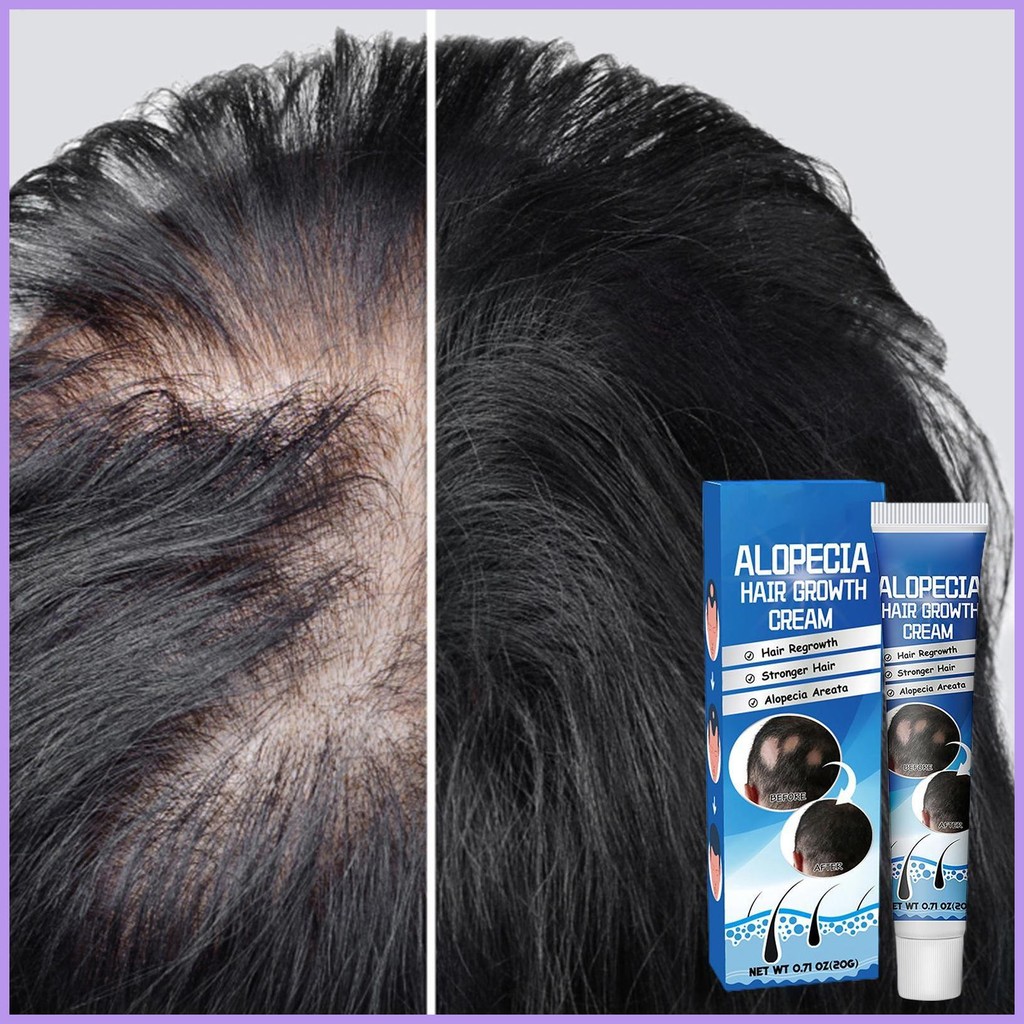 Baldness 20g Liquorice Regrowth Repair Cream Anti Alopecia Fast Hair ...