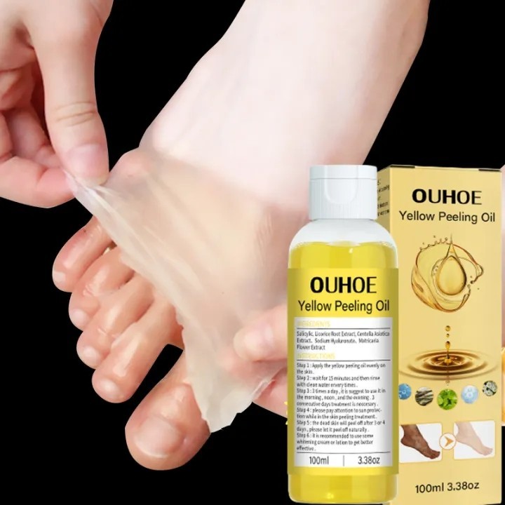100ml Yellow Peeling Lotion Remove Dead Skin Exfoliating Whitening and ...