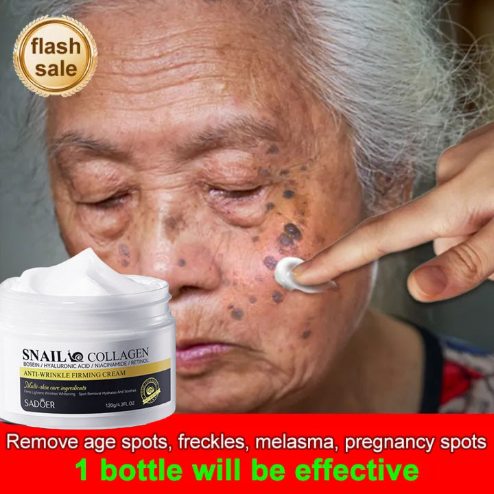 Snail Collagen Cream Melasma Remover Anti Aging Whitening Moisturizing ...