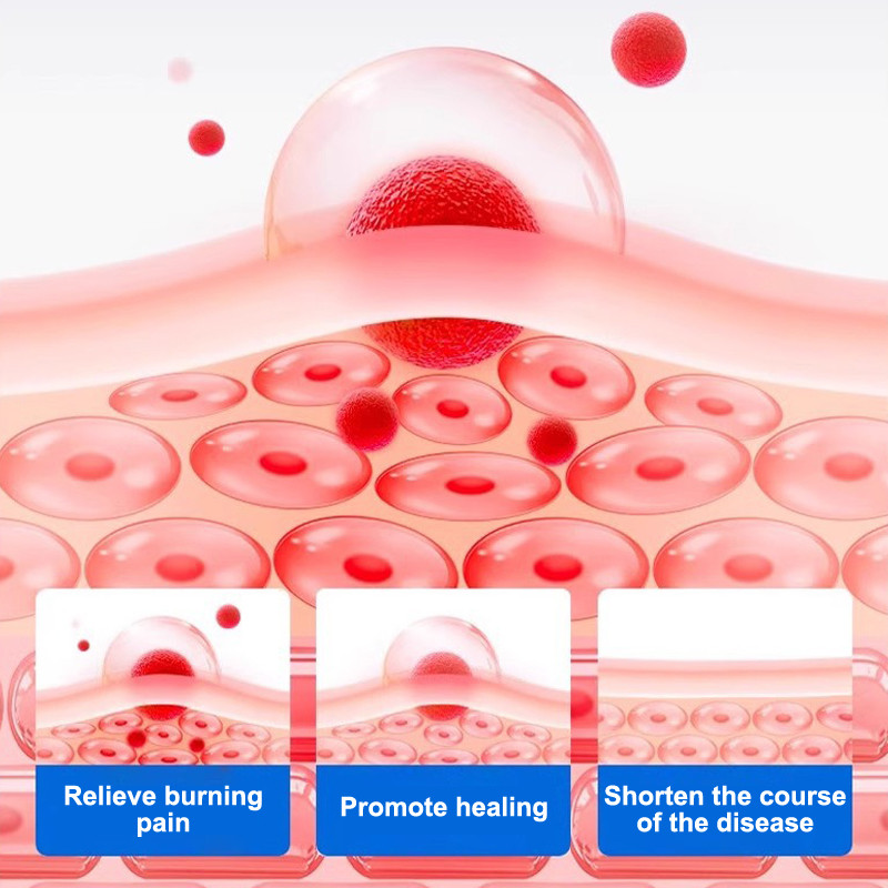 ThickRich Quick Care Mouth Ulcer Patch Oral Mouth Wound Dressing For ...