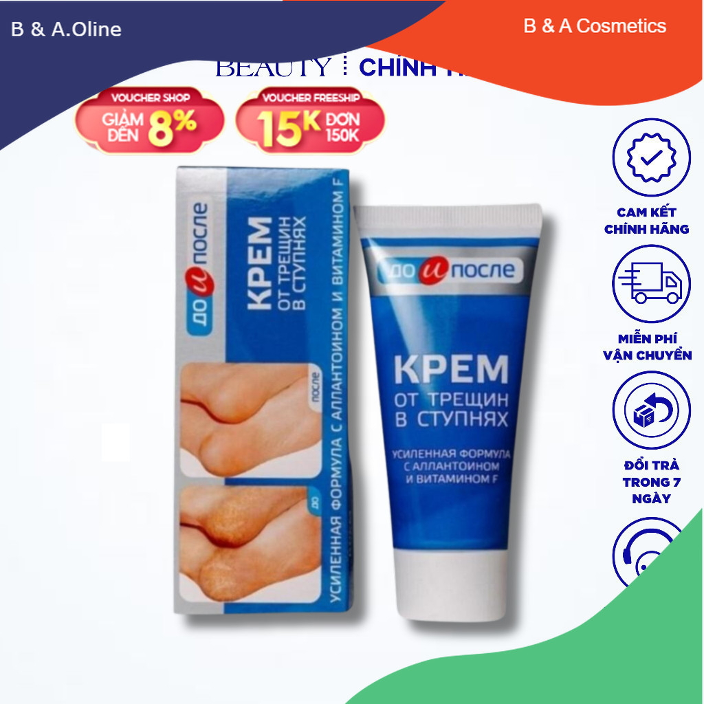 Kpem Russian Heel Chapped Cream 50ml Helps reduce Chapped Feet ...