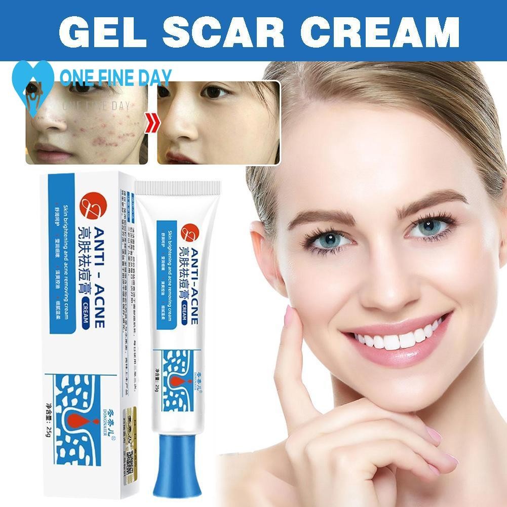 Brightening Acne Cream Facial Repair Dilute Acne Marks 100% Pimples ...