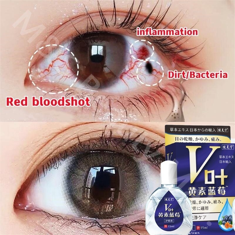 Japanese eye drops 15MB blueberry lutein eye drops, used to treat aging ...