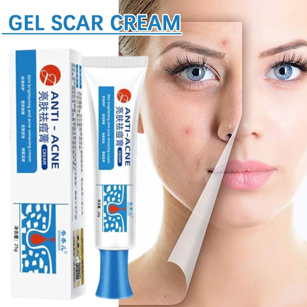 Brightening Acne Cream Facial Repair Dilute Acne Marks Skin 100% ...