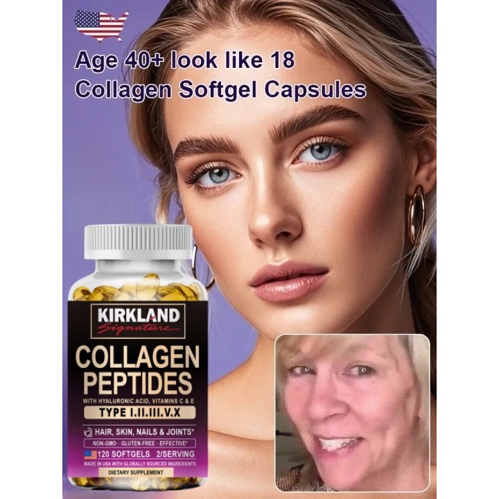 KIRK-LAND collagen soft capsules help skin collagen regeneration and ...