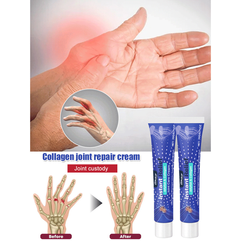 Topical Collagen Joint Repair Cream Apply to Relieve Swelling Pain ...