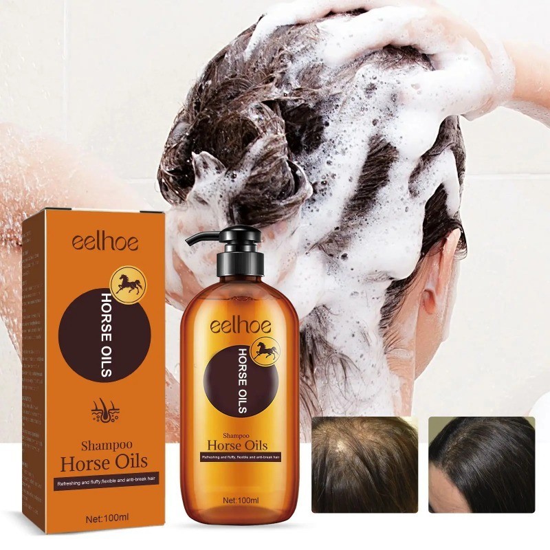 EELHOE Anti Hair Thinning Shampoo Prevent Hair Loss Regeneration ...
