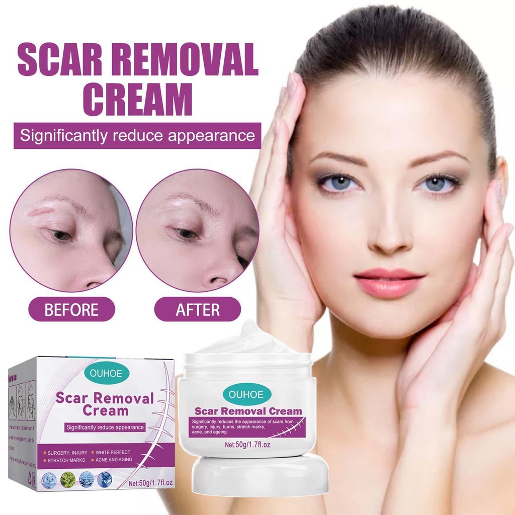 Scar Removal Cream Old and New Scar Repair Balm for Surgical Scars ...