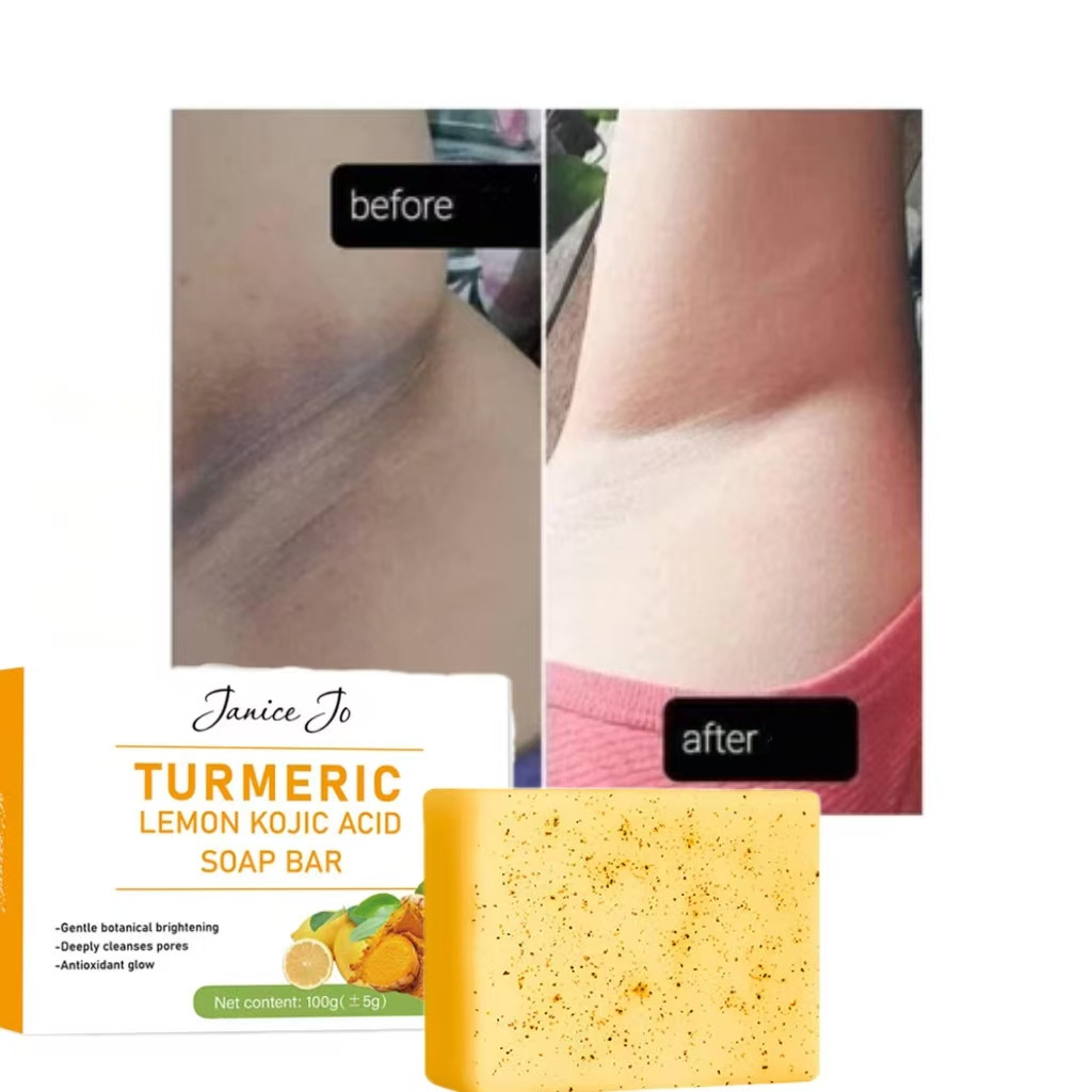 JaniceJo Kojic Acid Lemon Turmeric Underarm Butt Armpit Whitening ...