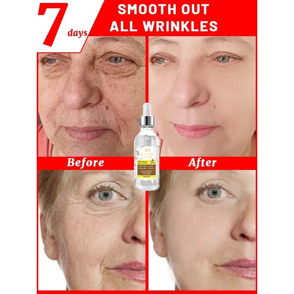 Anti-Wrinkle Essence Firming Oil Control Lifting Firming Lightening ...