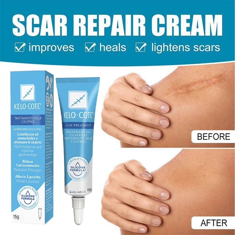 Effective Kelo-Cote Silicone Scar Gel stretch mark remover cream acne ...