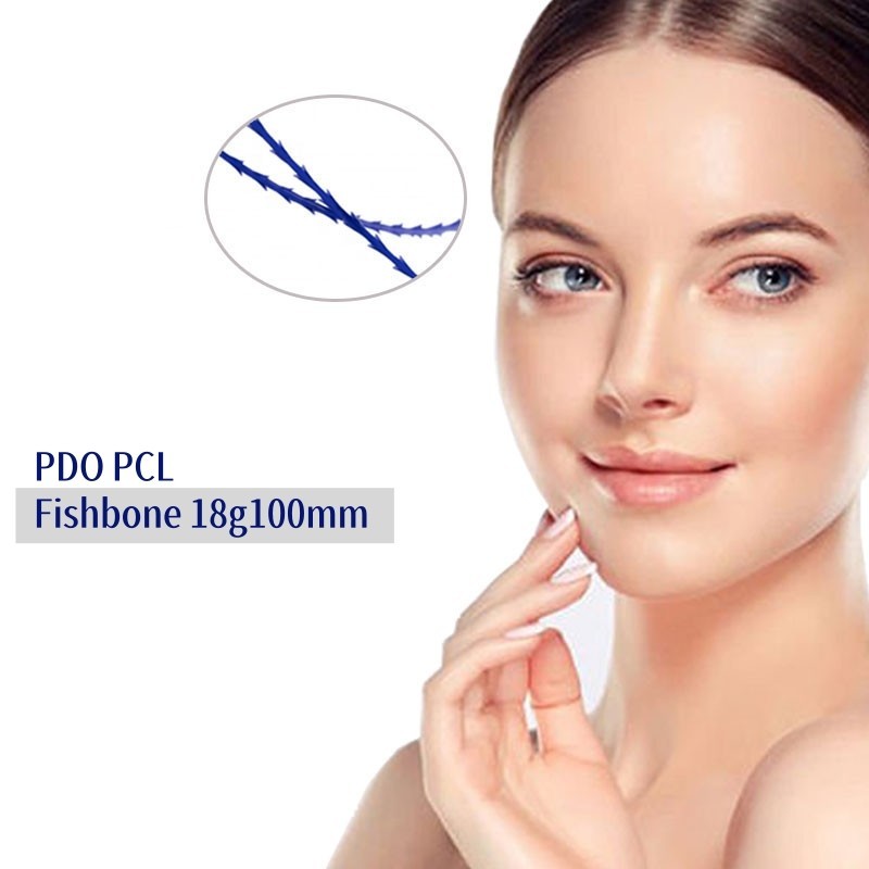 pdo thread lift UVERLA 18g 100mm fishbone Pdo Pcl for Face Lifting thread 20pcs/pack | Shopee ...