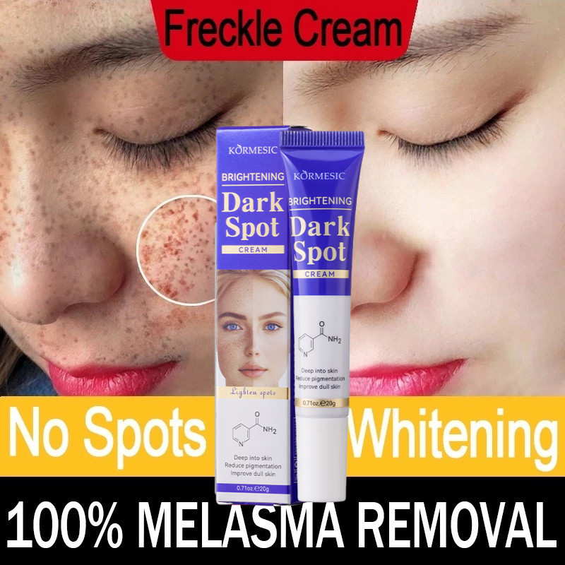 Pekas Remover Effective Melasma Cream Anti Freckle Collagen Skin ...