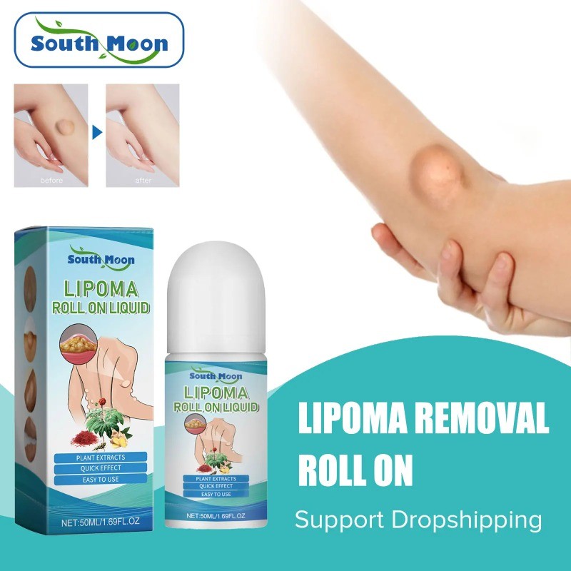 Lumps Elimination Roll On Anti-Swelling Lipoma Breast Subcutaneous ...