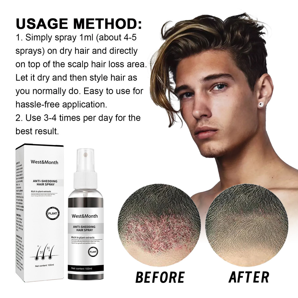 Anti-hair Loss Spray Improve Hairline Dense Hair Strong Hair Nourish ...