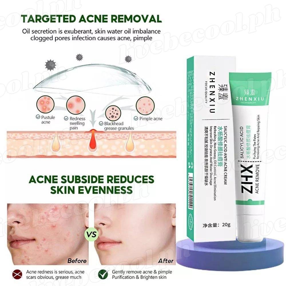 Zhenxiu Salicylic Acid Face Cream Anti Acne Fade Acne Lighten Acne ...