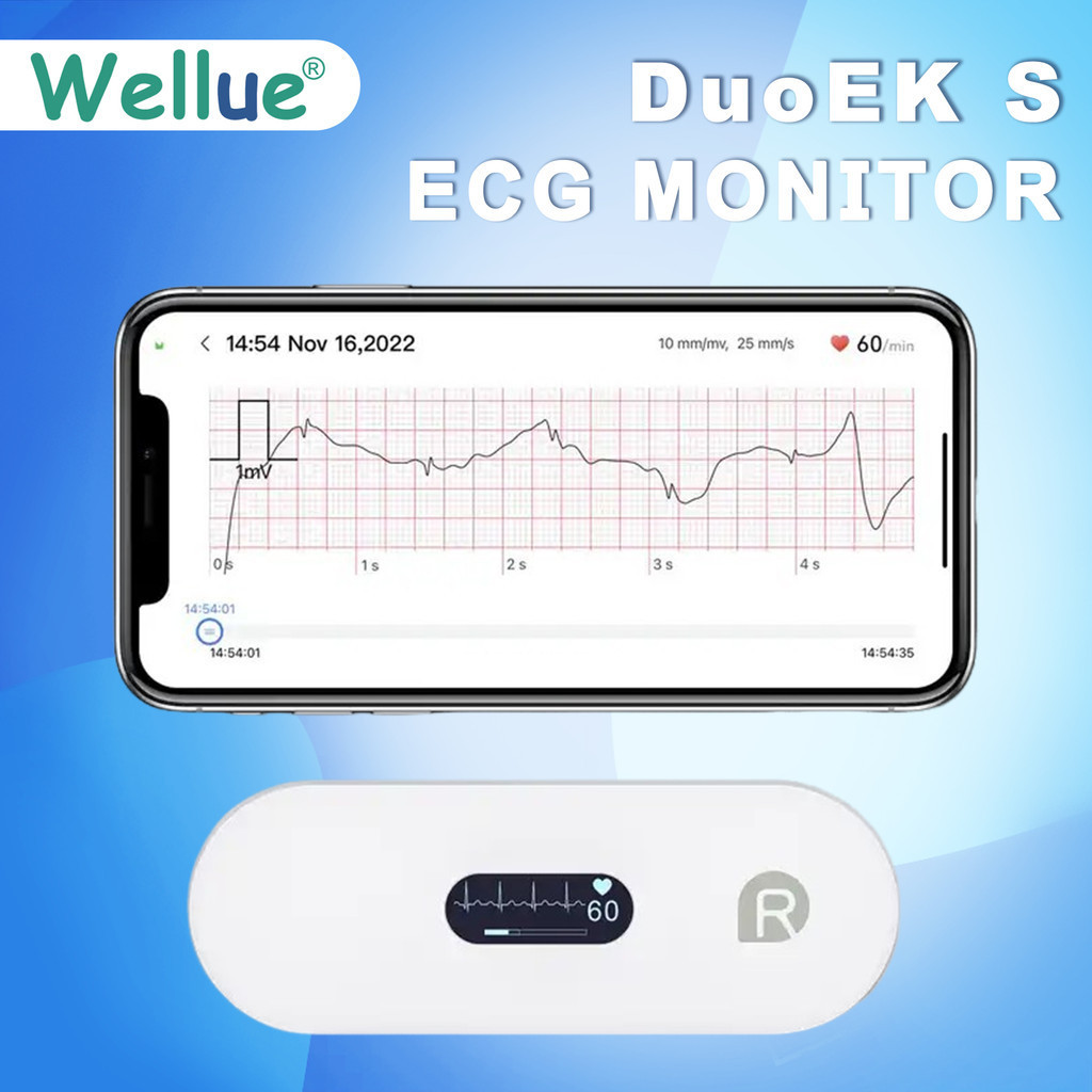 Wellue Holter Ecg Electrocardiogram Heart Rate Ecg Monitor Portable Ekg ...