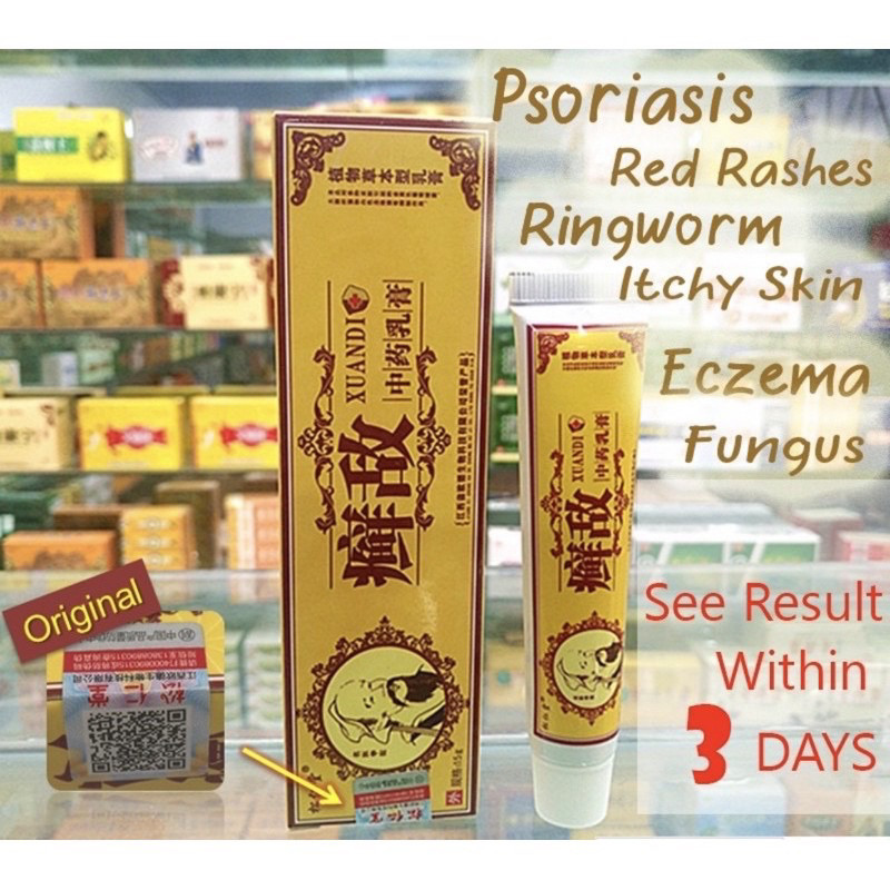 Y63 5pcs 100% XUANDI Krim Kurap Kudis Psiorasis Ekzema Panau Fungus ...