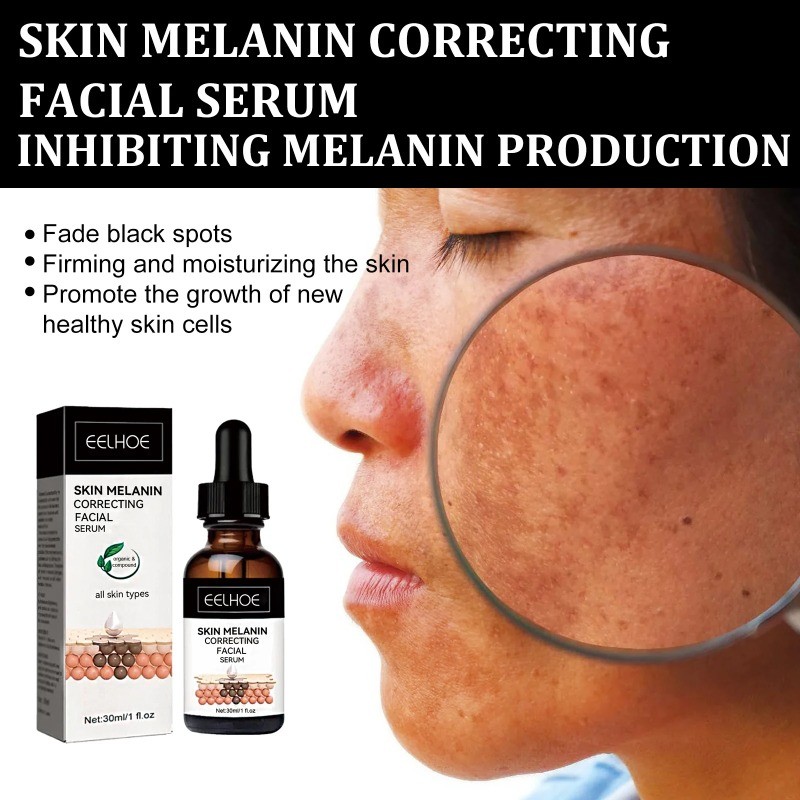 EELHOE Melanin Correcting Serum Fade Dark Spots Anti Freckle Melasma Remover Lightening Pigment ...