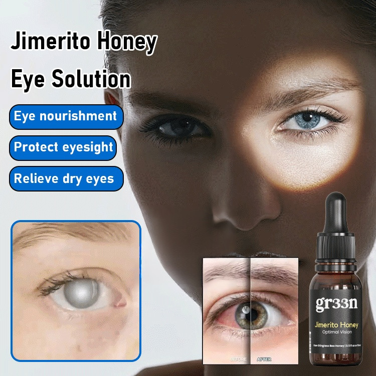 【1/2PCS】Eye Care Solution Soothing Eye Drops Melon Eye Care Solution ...