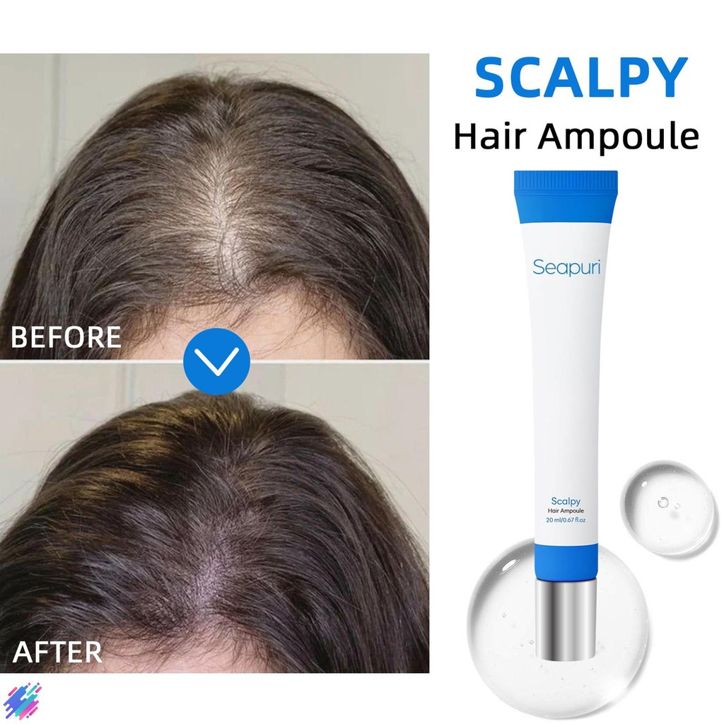 Scalpy Hair Growth Serum for Hair Loss Daily Hair Care Smoothing Serum ...