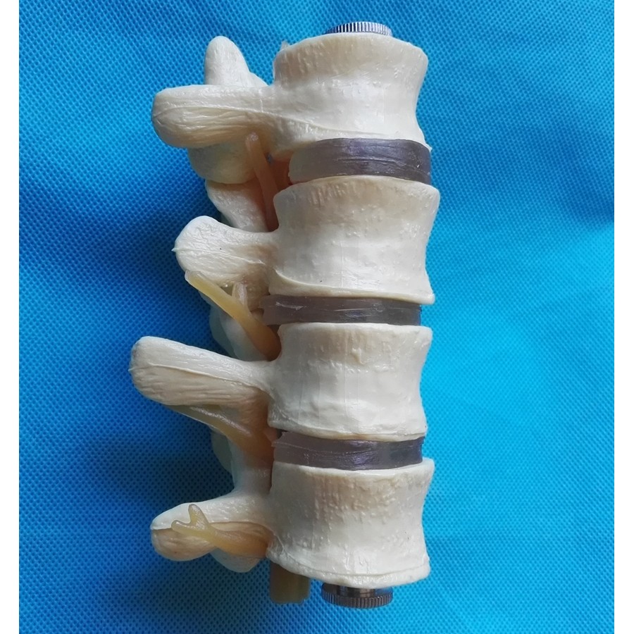Good Quality Detachable 1: 1 Human Body Lumbar Spine Model Spine Bone ...