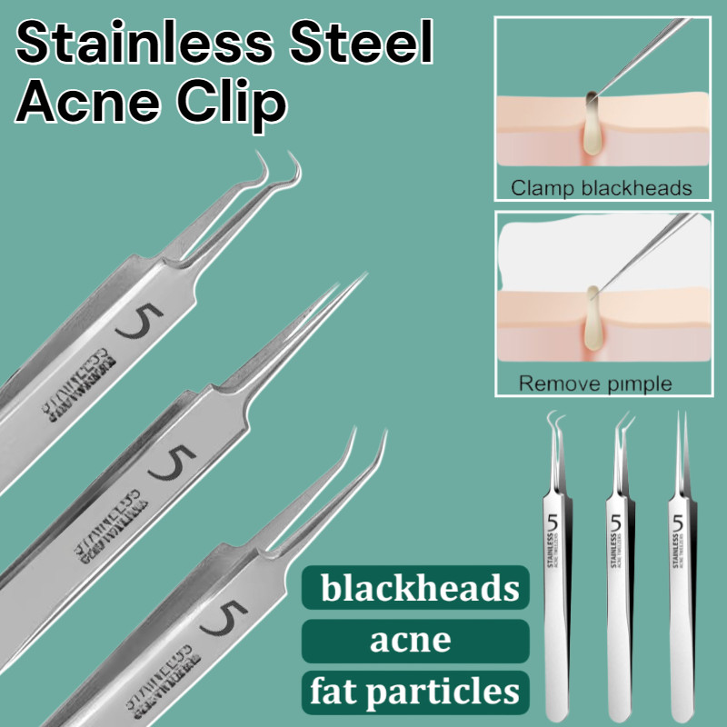 A set Stainless Steel Acne Black Heads Remover Tool/Cell Tweezers/Acne ...