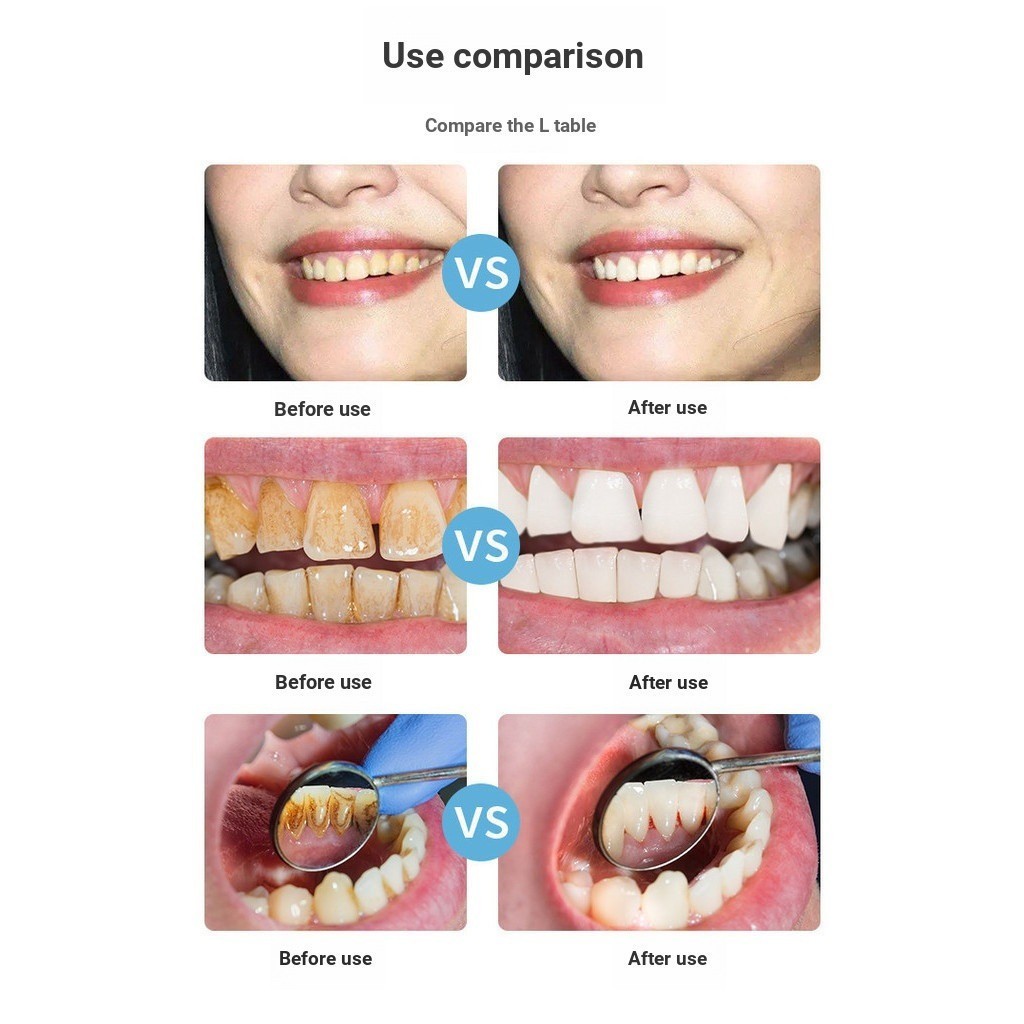 【NEW】Japan Teeth whitening teeth cleaner tartar remover teeth whitening ...