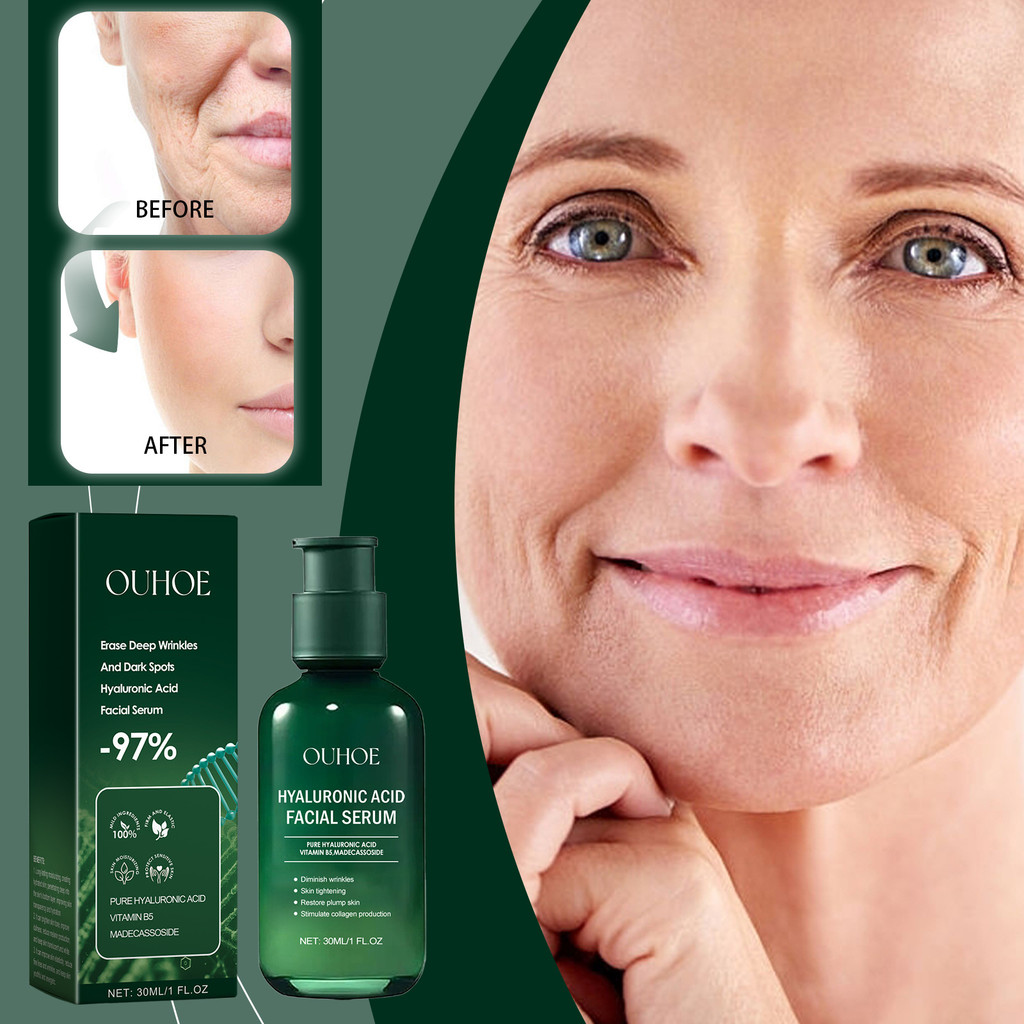 Erase Deep Wrinkles And Dark Spots Hyaluronic Acid Facial Serum 30ml ...