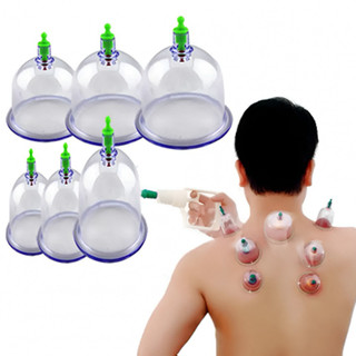 12pcs Ventosa Massage Cups – Traditional Vacuum Therapy for Body Health ...