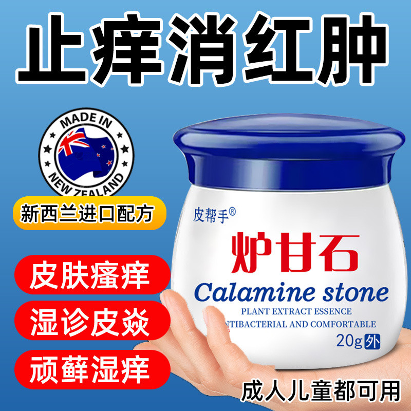 New Zealand Calamine Cream for Adults and Children, Eczema, Dermatitis ...