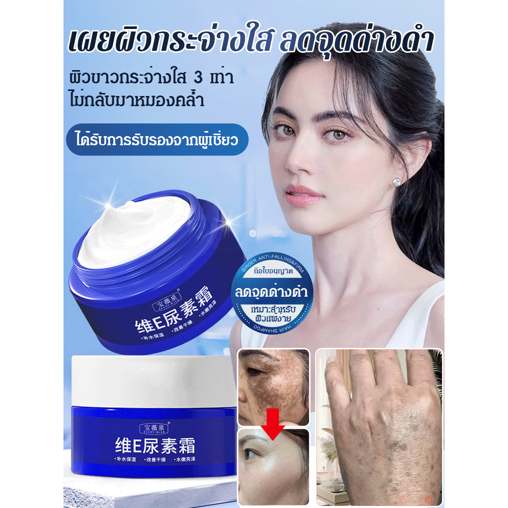 Baoweiquan One-touch Urea Cream Skin Care Spot-fading Old Spots Macular Whitening Cream | Shopee ...